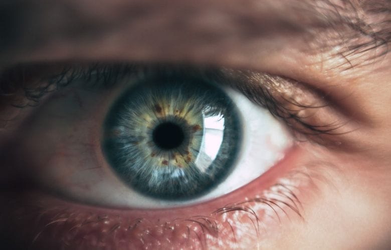 Eye migraines: these are the symptoms and how you might be able to ...