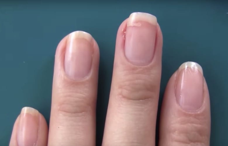 Ouch, a torn nail! With this weird trick you could repair it in no time
